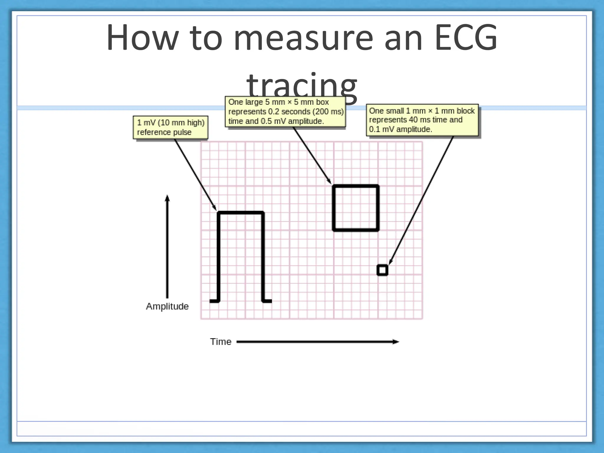 ECG Basics.pptx