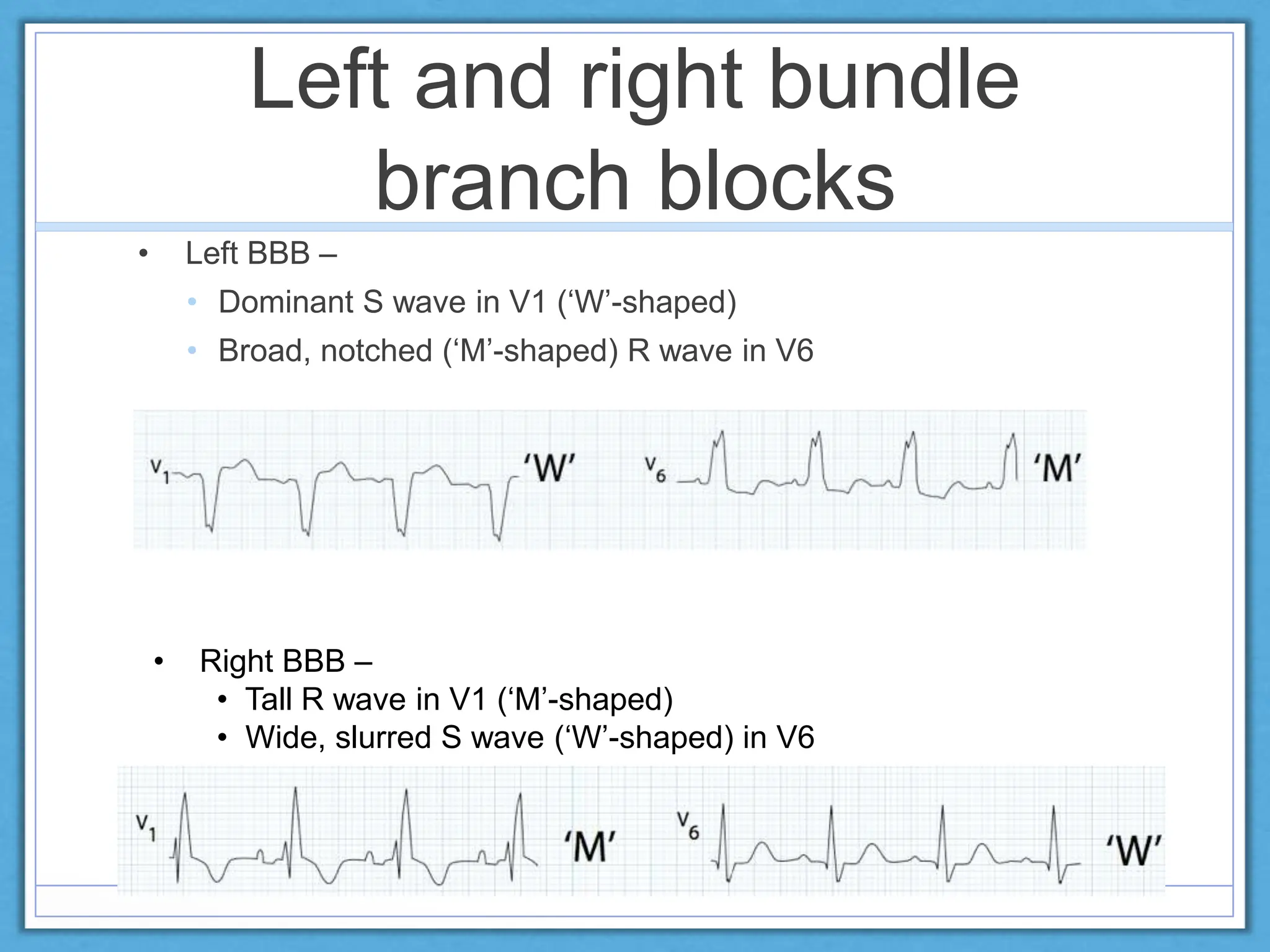 ECG Basics.pptx