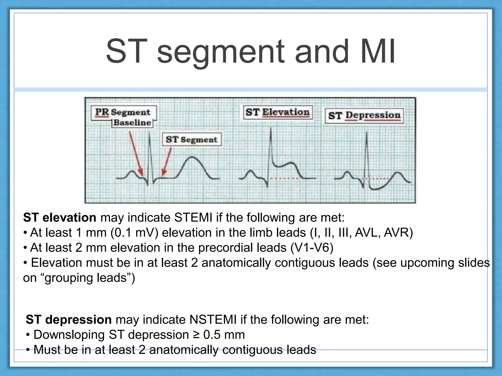 ECG Basics.pptx