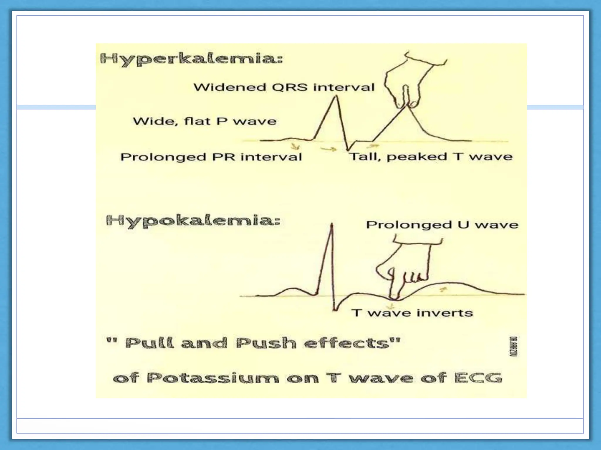 ECG Basics.pptx