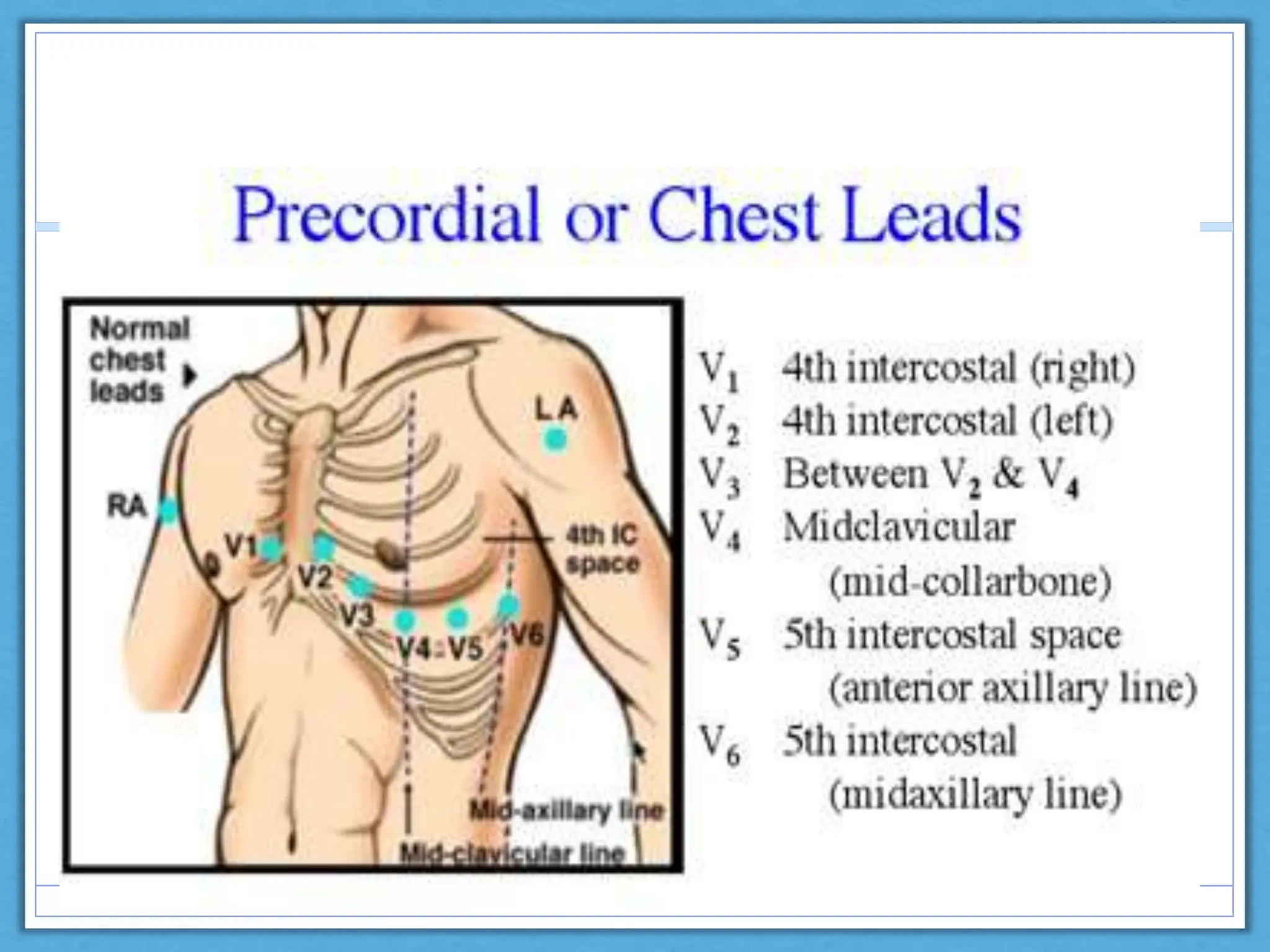 ECG Basics.pptx