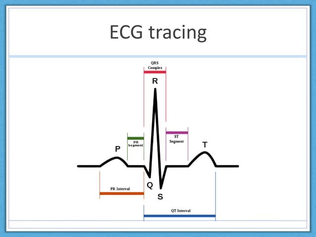 ECG Basics.pptx