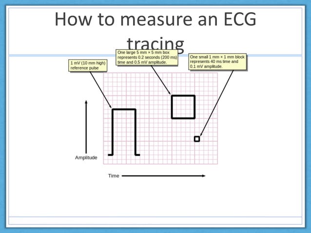 ECG Basics.pptx