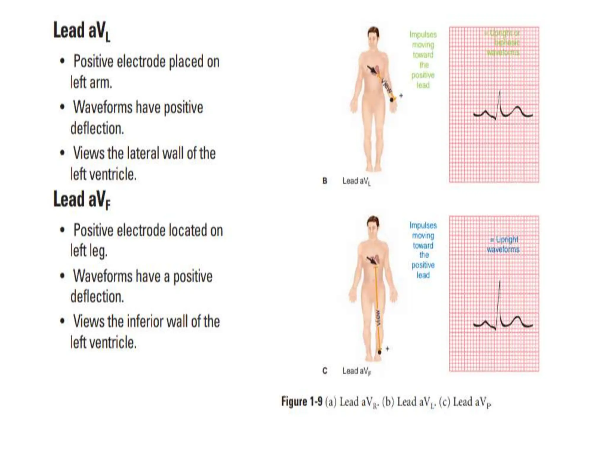 ECG BASICS , HOW TO TAKE ECG AND PLACEMENT OF LEADS | PPTX