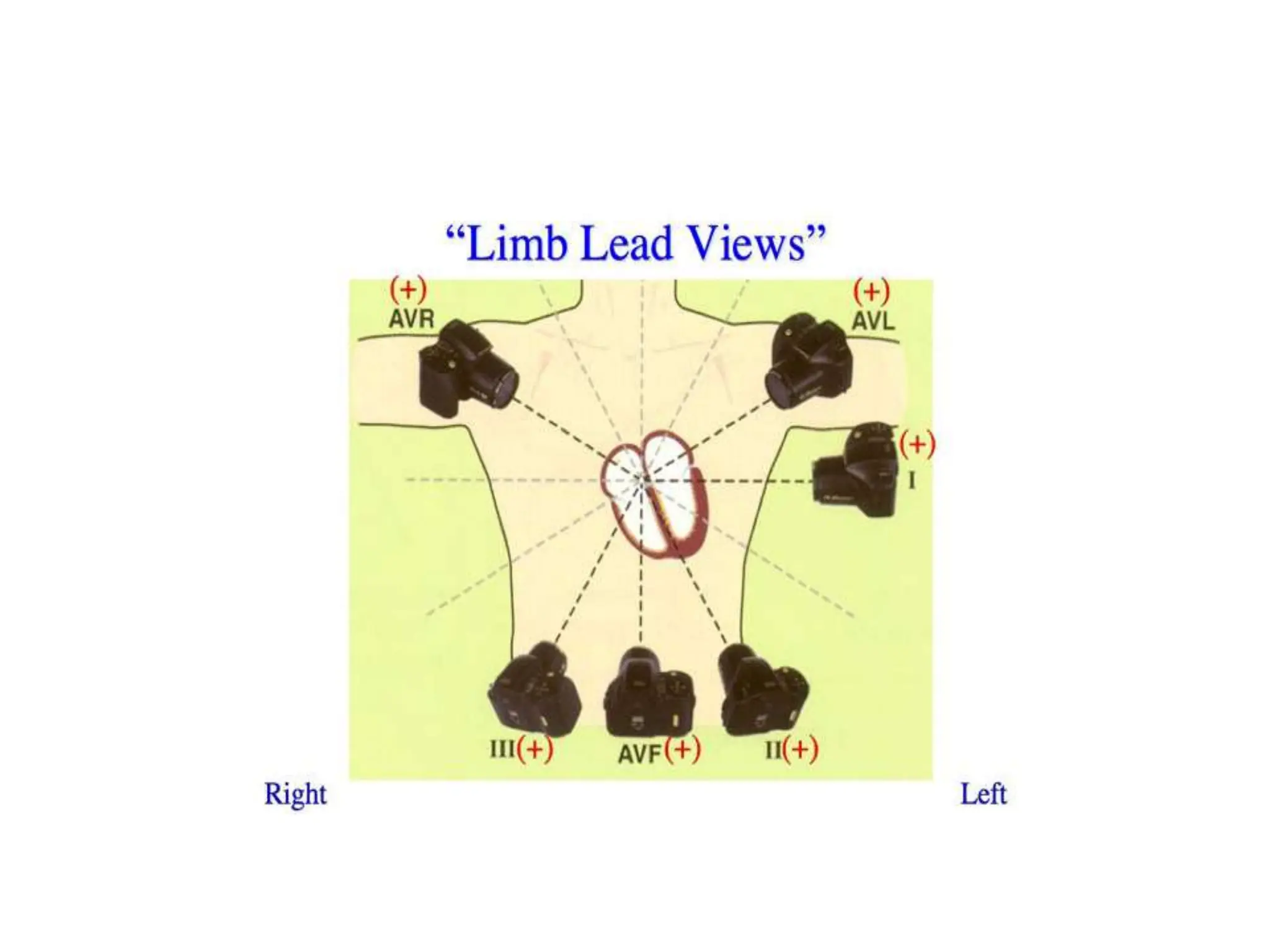 ECG BASICS , HOW TO TAKE ECG AND PLACEMENT OF LEADS | PPTX