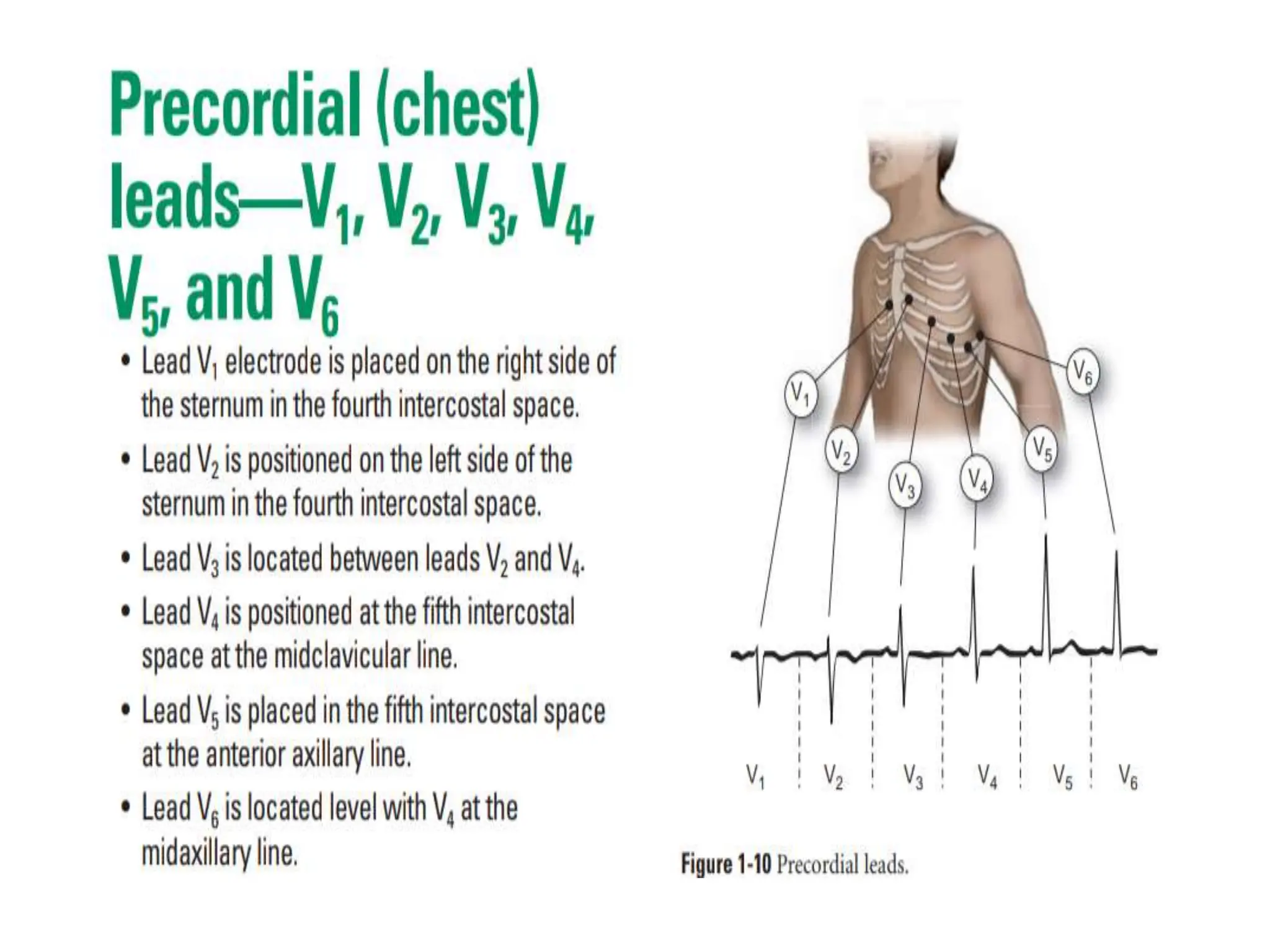 ECG BASICS , HOW TO TAKE ECG AND PLACEMENT OF LEADS | PPTX