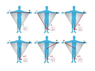 ECG BASICS , HOW TO TAKE ECG AND PLACEMENT OF LEADS | PPTX