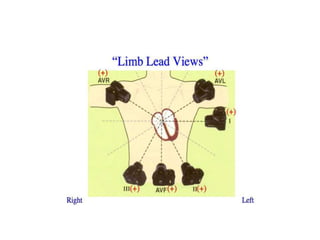 ECG BASICS , HOW TO TAKE ECG AND PLACEMENT OF LEADS | PPTX
