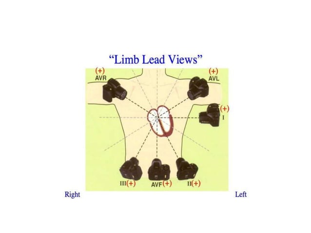 ECG BASICS , HOW TO TAKE ECG AND PLACEMENT OF LEADS | PPTX | Heart and ...