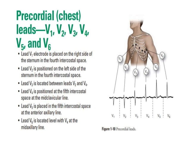 ECG BASICS , HOW TO TAKE ECG AND PLACEMENT OF LEADS | PPTX | Heart and ...