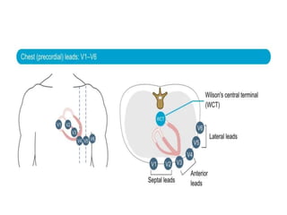 ECG BASICS , HOW TO TAKE ECG AND PLACEMENT OF LEADS | PPTX