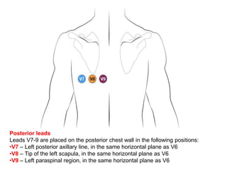 ECG BASICS , HOW TO TAKE ECG AND PLACEMENT OF LEADS | PPTX