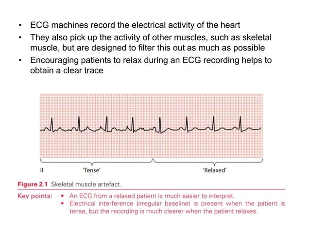ECG BASICS , HOW TO TAKE ECG AND PLACEMENT OF LEADS | PPTX | Heart and ...