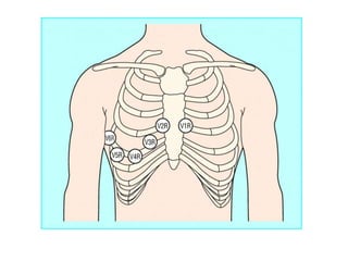 ECG BASICS , HOW TO TAKE ECG AND PLACEMENT OF LEADS | PPTX