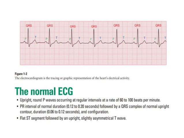 ECG BASICS , HOW TO TAKE ECG AND PLACEMENT OF LEADS | PPTX | Heart and ...