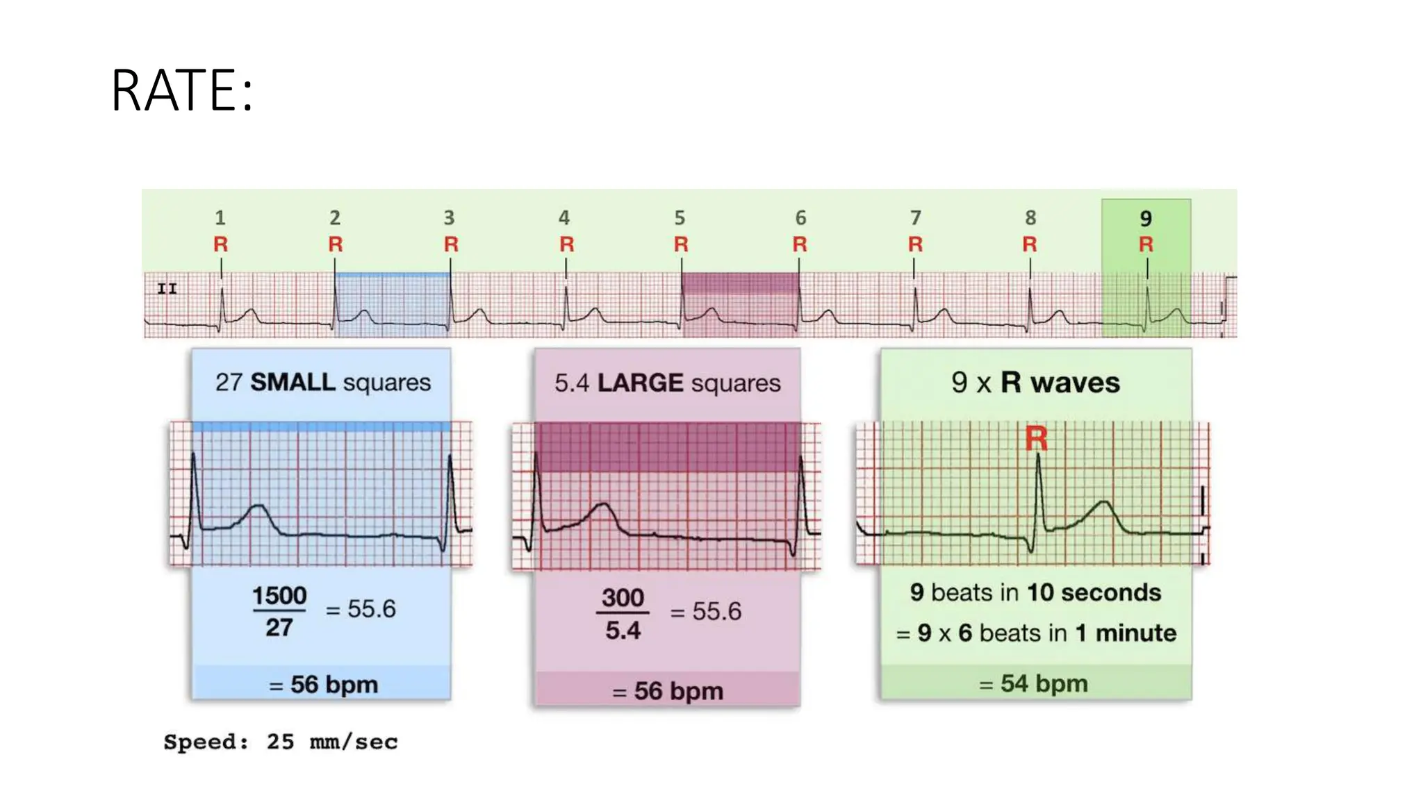 ecg basics for physiotherapy students reference purpose | PPTX