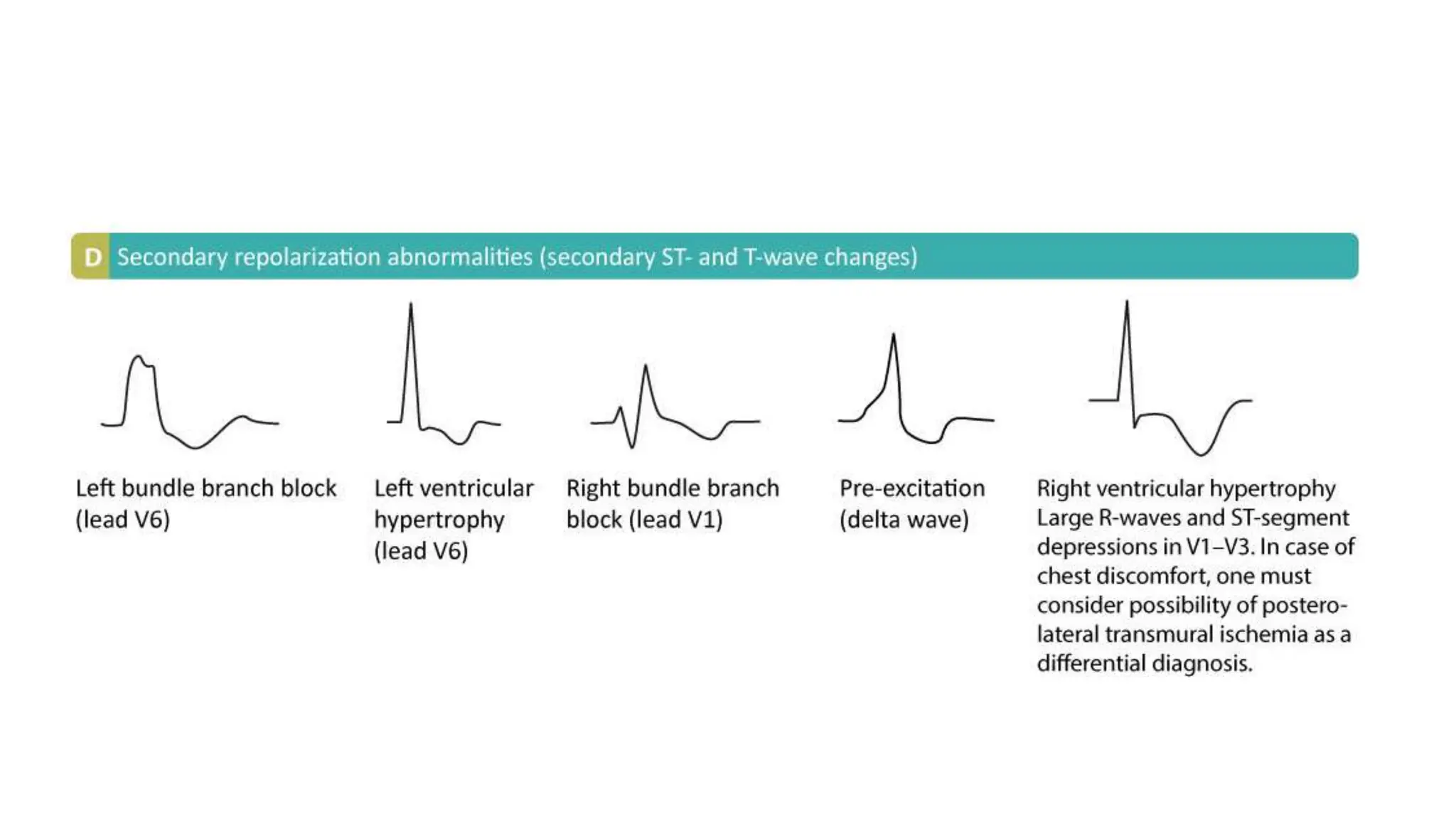 ecg basics for physiotherapy students reference purpose | PPTX