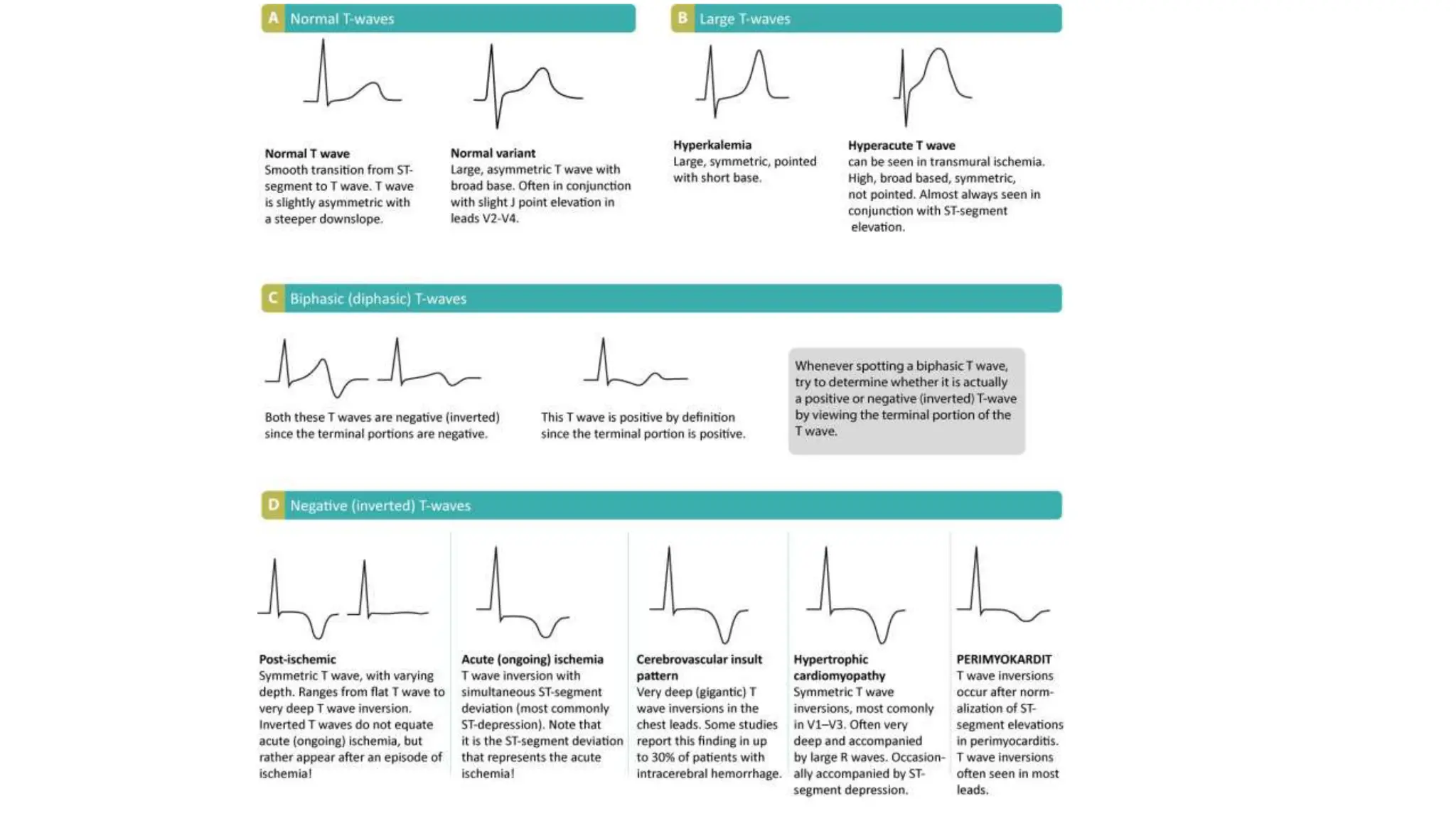 ecg basics for physiotherapy students reference purpose | PPTX