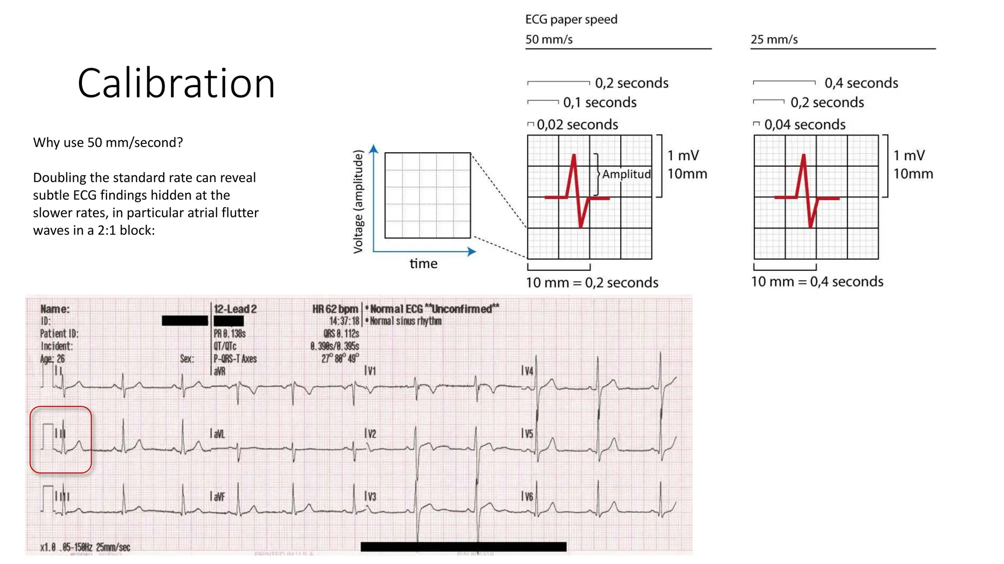 ecg basics for physiotherapy students reference purpose | PPTX