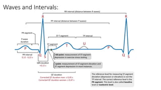 ecg basics for physiotherapy students reference purpose | PPTX