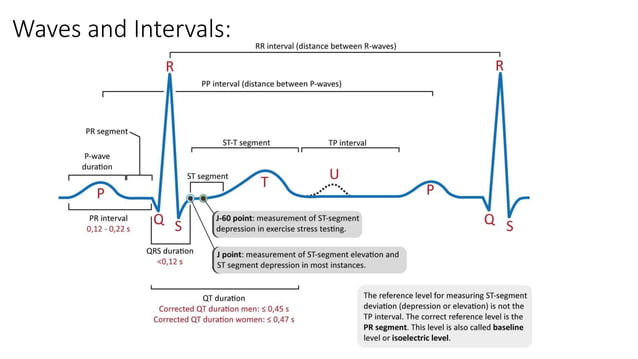 ecg basics for physiotherapy students reference purpose | PPTX | Heart ...