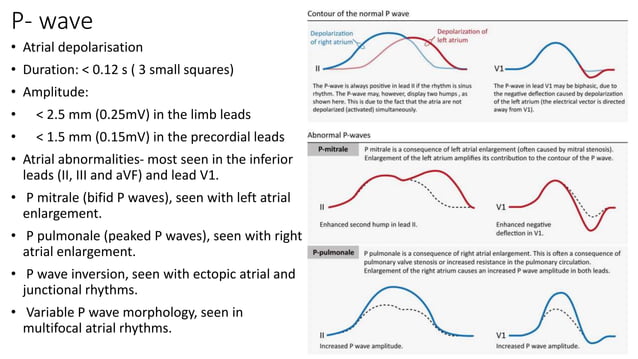 ecg basics for physiotherapy students reference purpose | PPTX | Heart ...