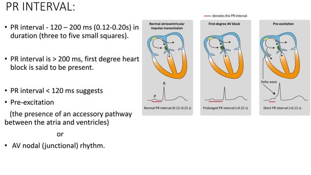 ecg basics for physiotherapy students reference purpose | PPTX | Heart ...