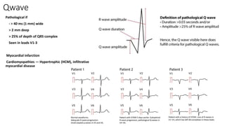 ecg basics for physiotherapy students reference purpose | PPTX