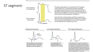 ecg basics for physiotherapy students reference purpose | PPTX | Heart ...