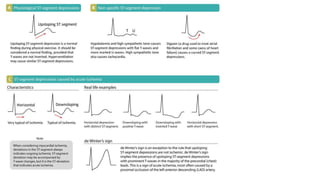 ecg basics for physiotherapy students reference purpose | PPTX