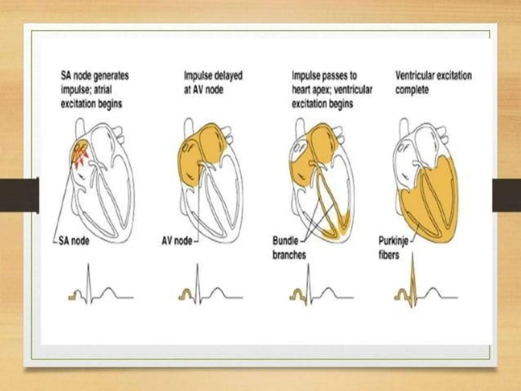 Ecginterpretation of acute acs basics.pptx