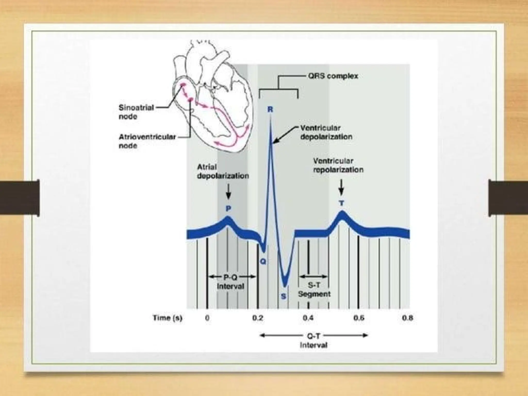 Ecginterpretation of acute acs basics.pptx