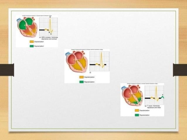 Ecginterpretation of acute acs basics.pptx