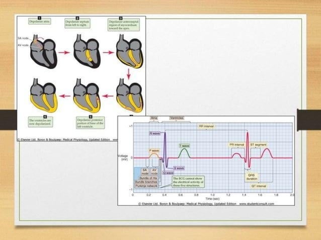Ecginterpretation of acute acs basics.pptx