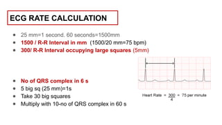 ECG basics powerpoint presentation slides | PPTX