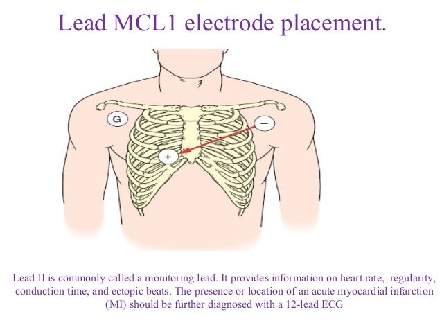 Ecg basics 1
