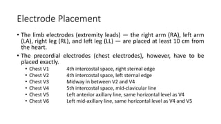 ECG Basics 1.pptx