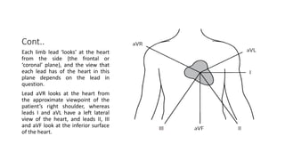 ECG Basics 1.pptx