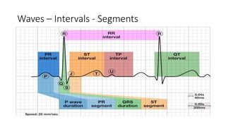 ECG Basics 1.pptx