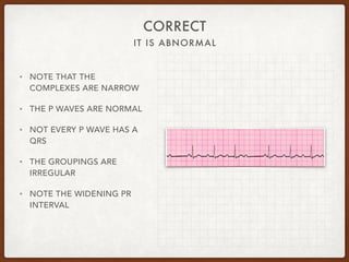 Ecg basics 2 pdf | PDF