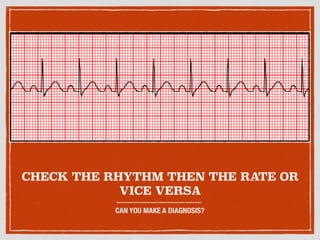 Ecg basics 3 pdf | PDF