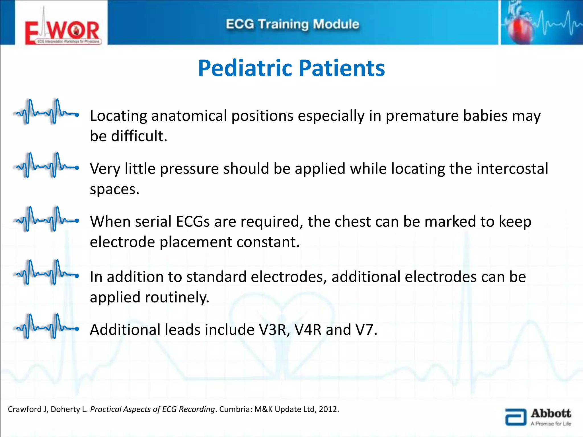 Ecg basics and interpretation | PPTX