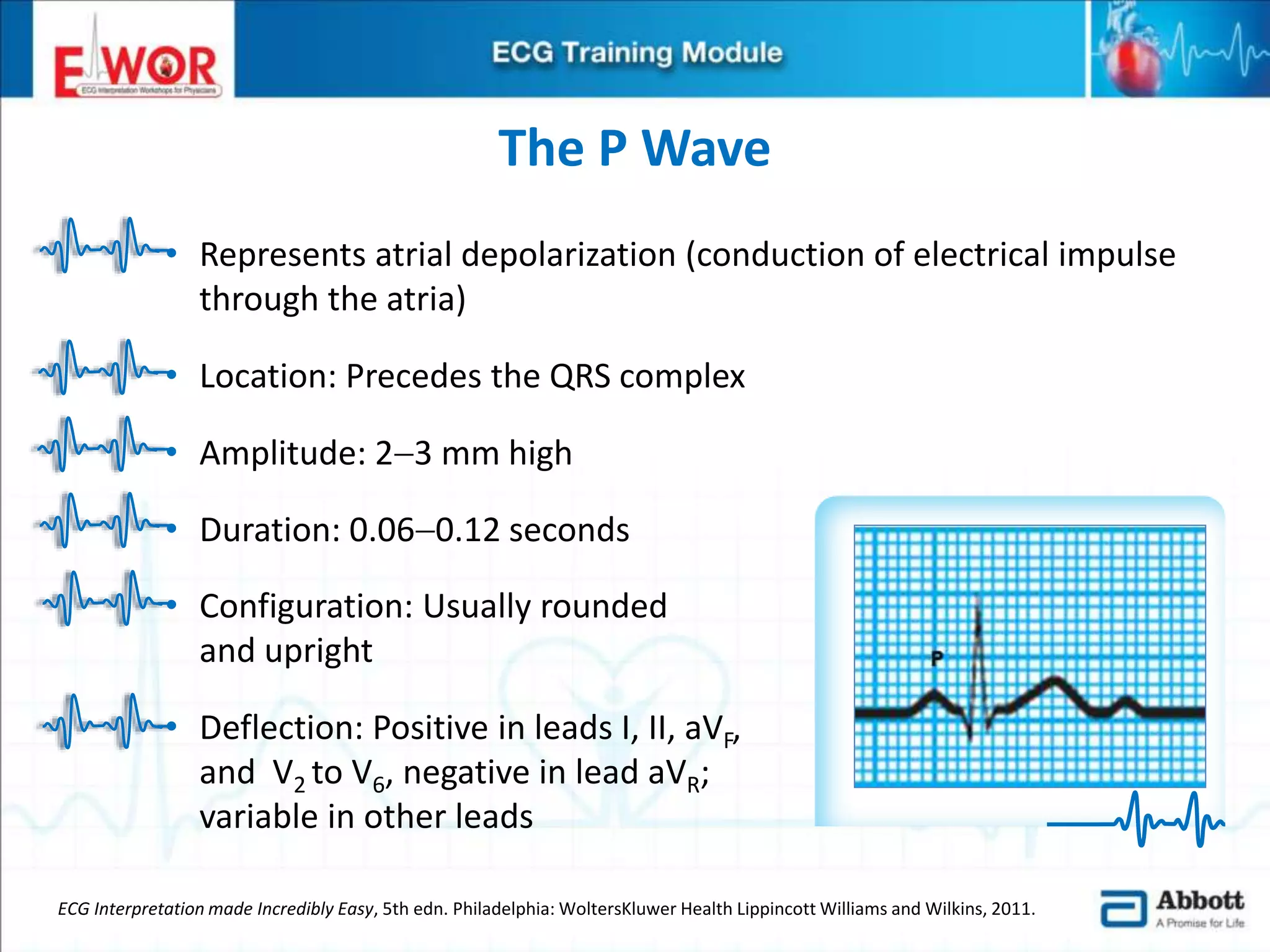 Ecg basics and interpretation | PPTX