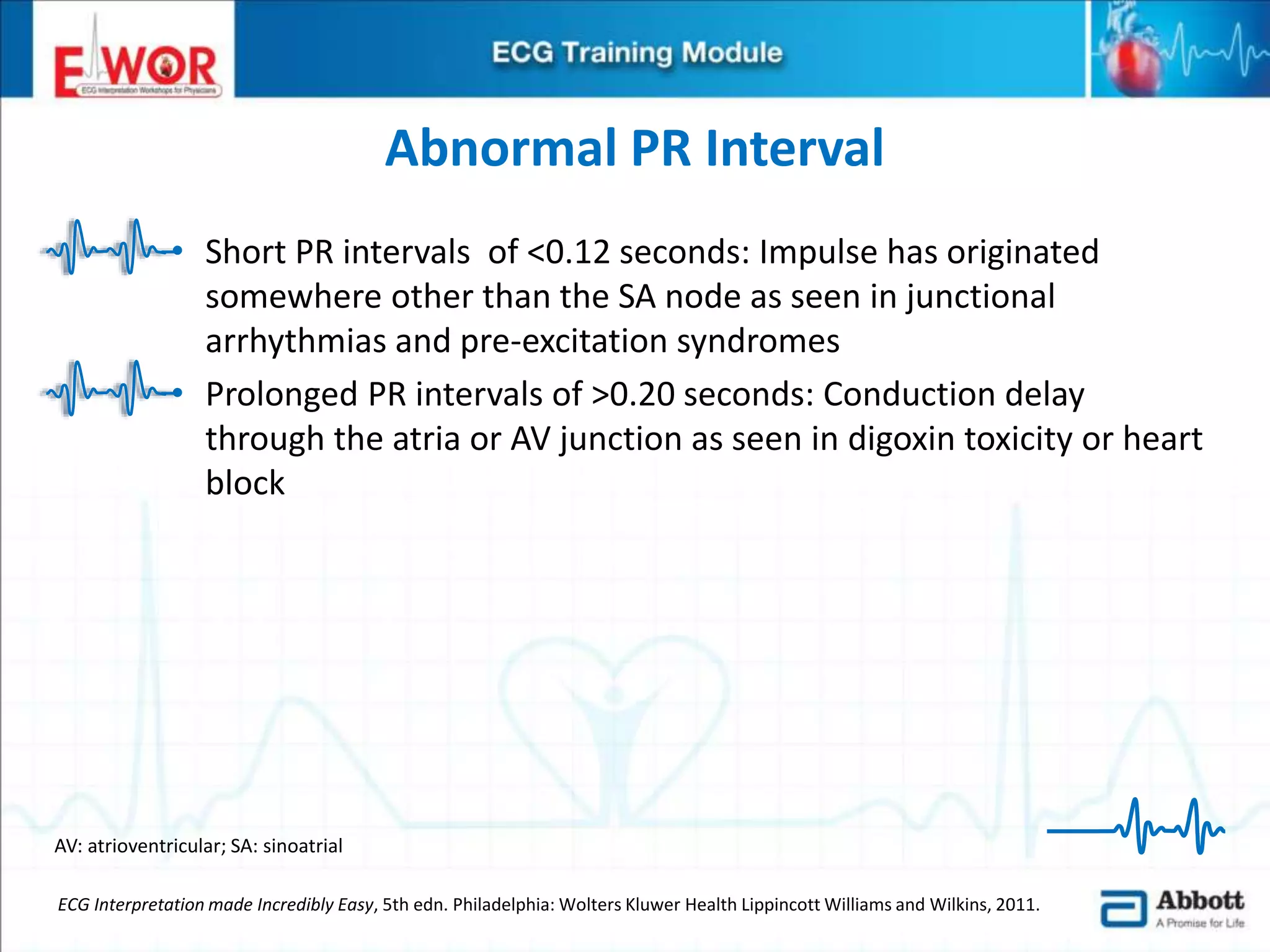 Ecg basics and interpretation | PPTX