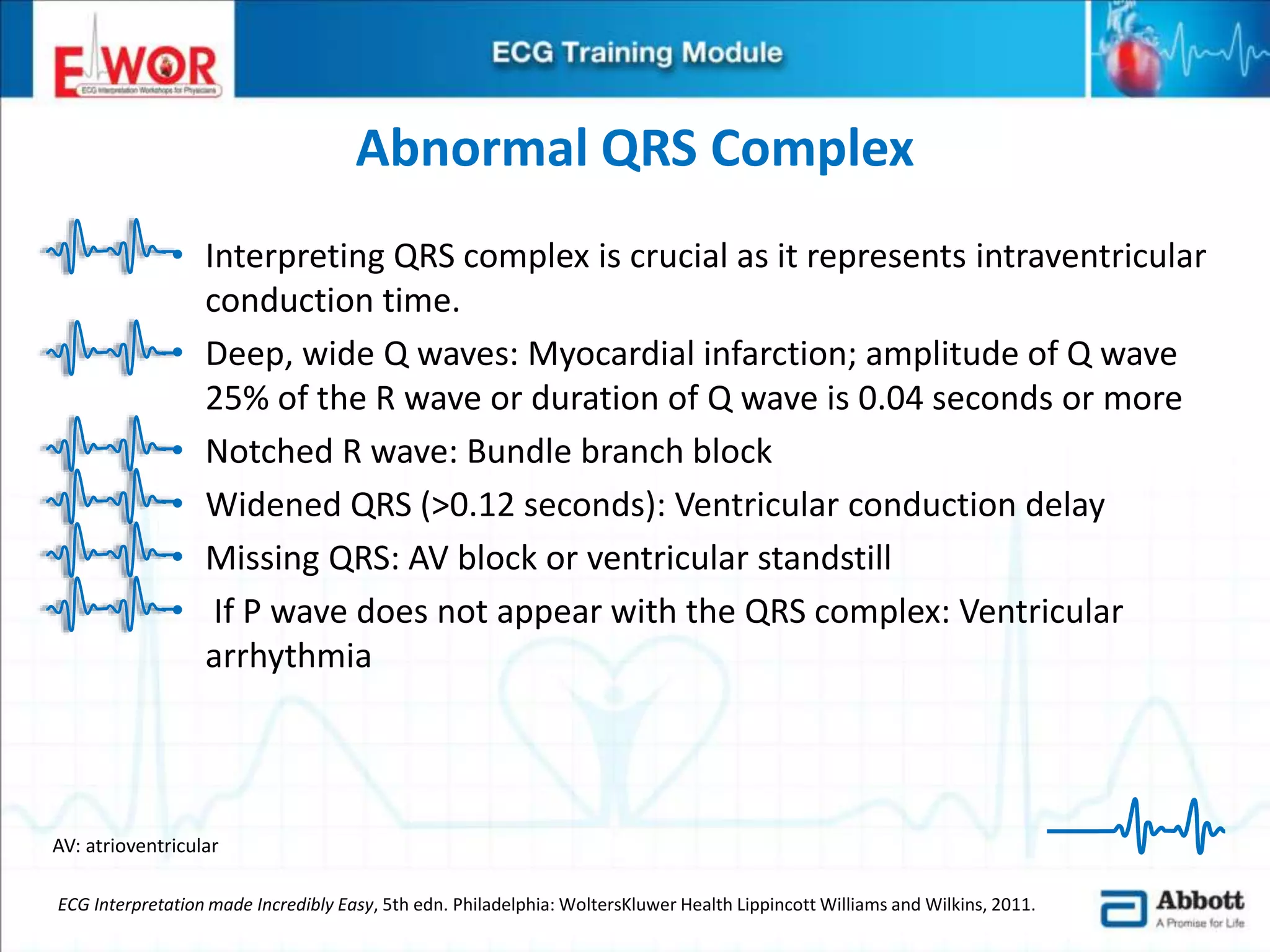 Ecg basics and interpretation | PPTX