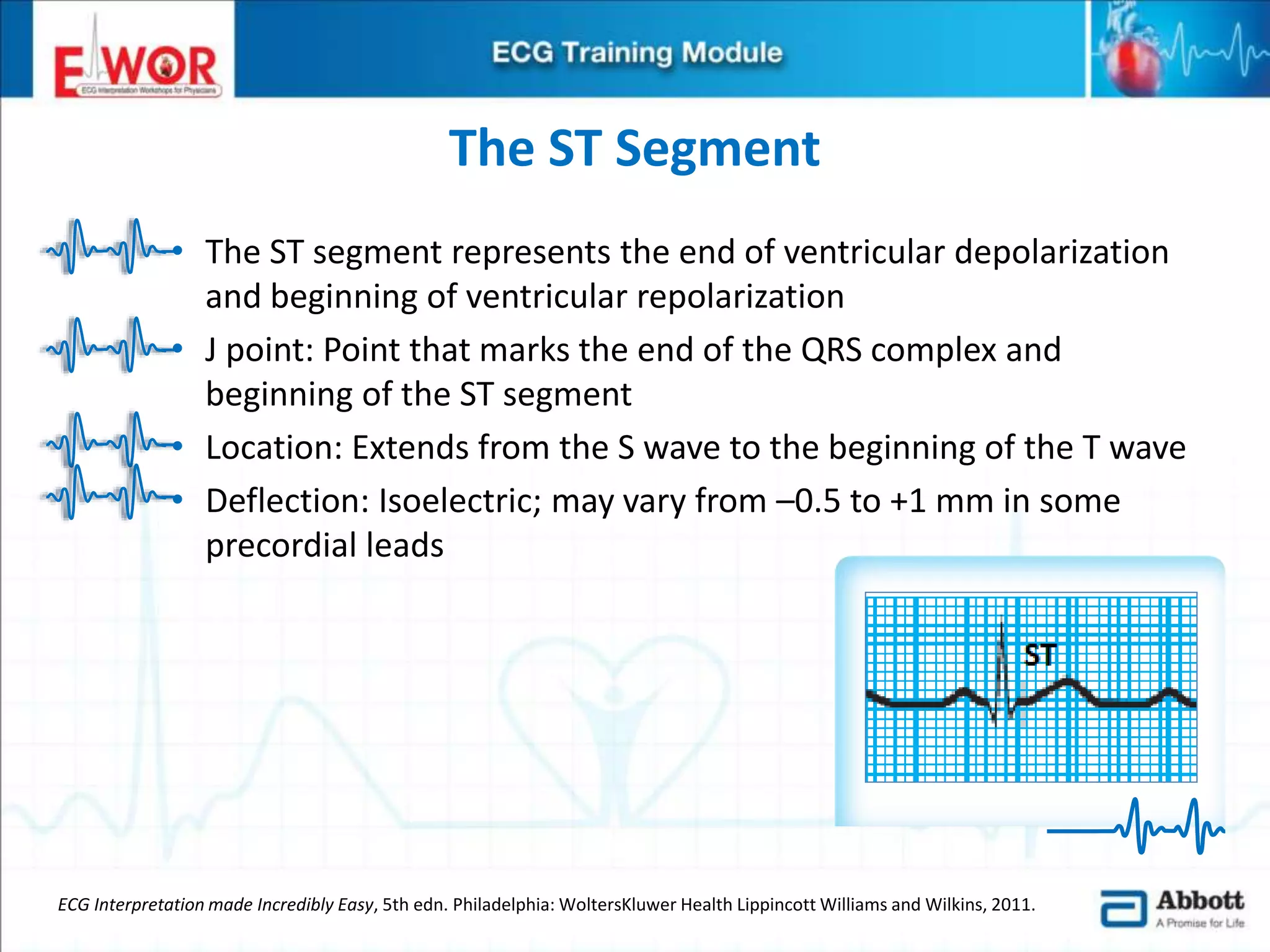 Ecg basics and interpretation | PPTX