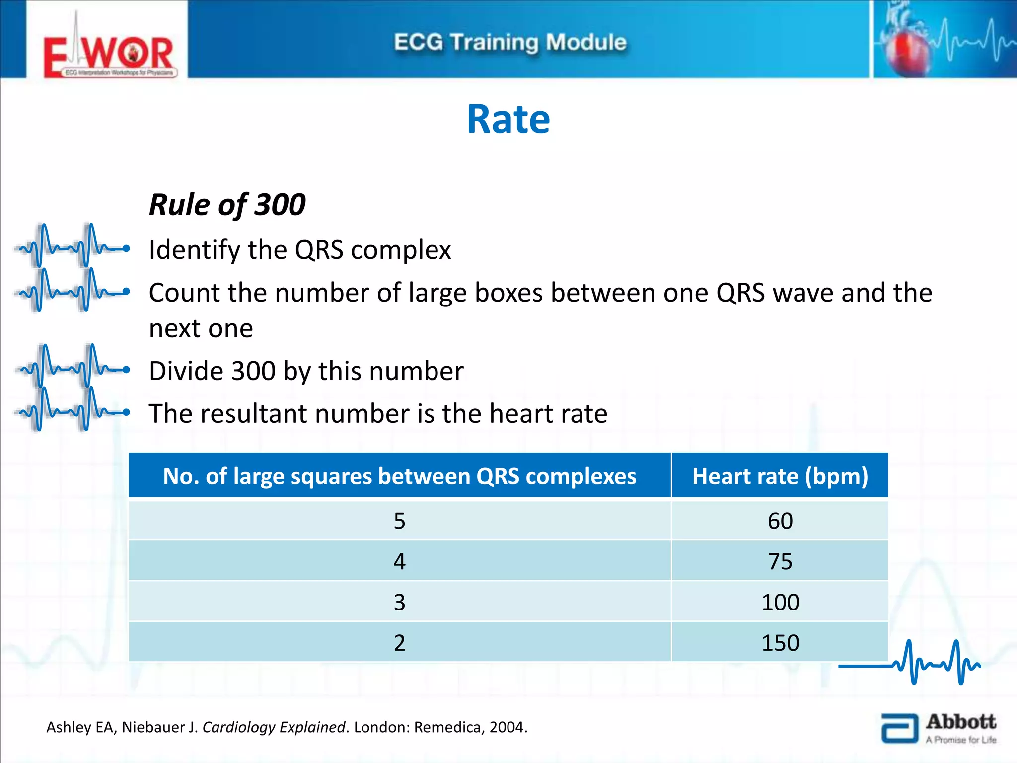 Ecg basics and interpretation | PPTX