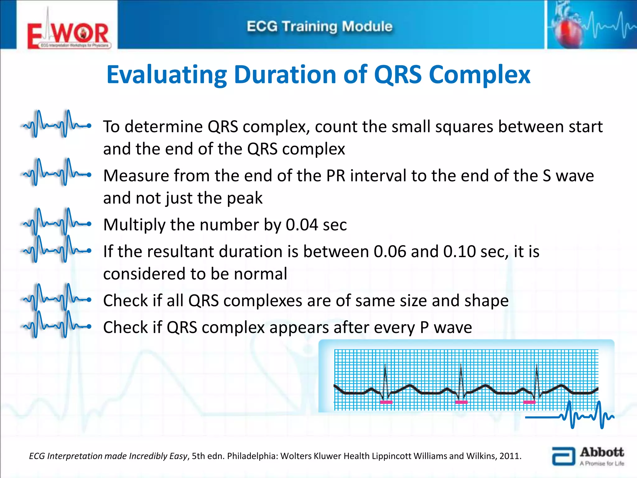 Ecg basics and interpretation | PPTX