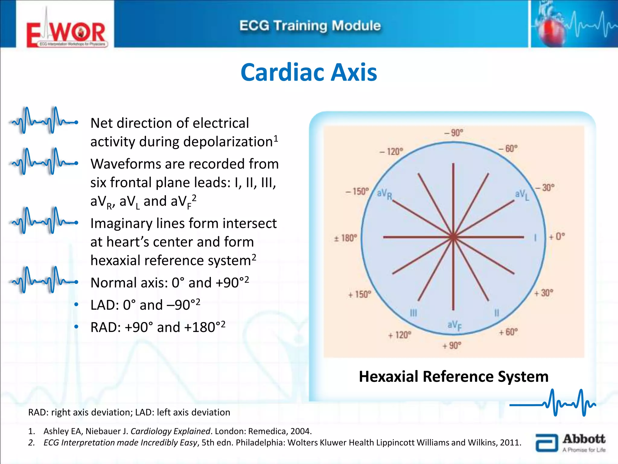 Ecg basics and interpretation | PPTX