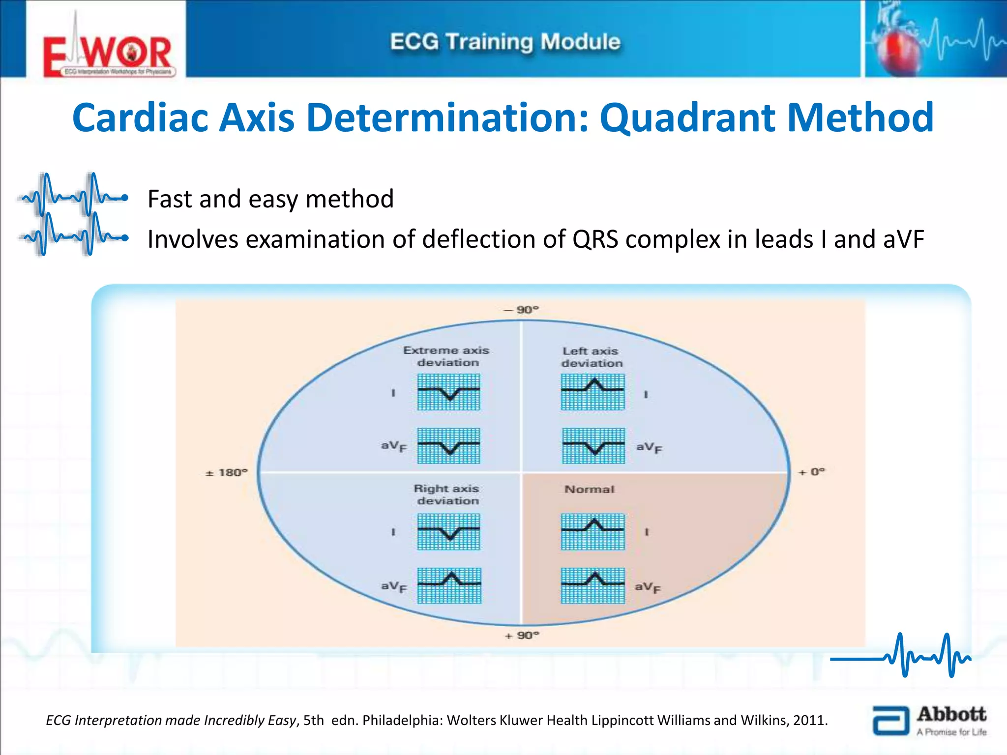 Ecg basics and interpretation | PPTX